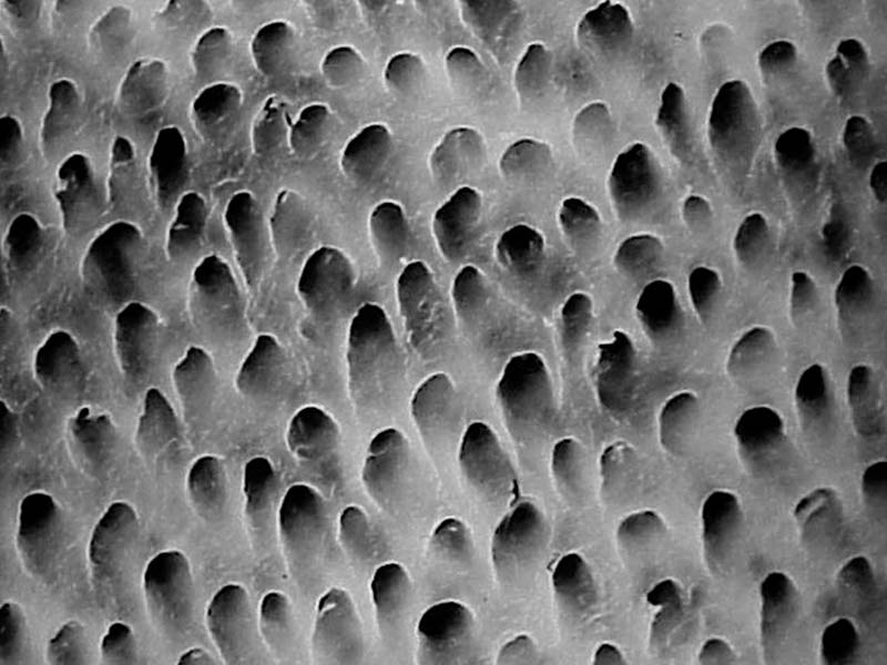 Etch-Rite™ - PULPDENT