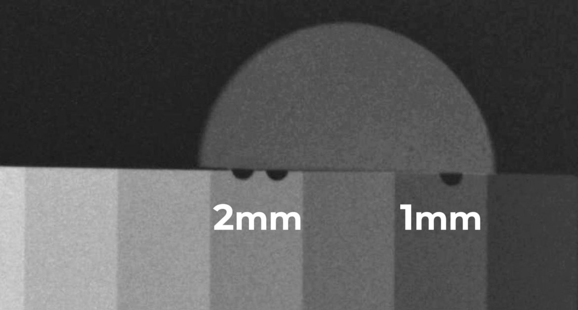 ACTIVA BioACTIVE Overview PULPDENT